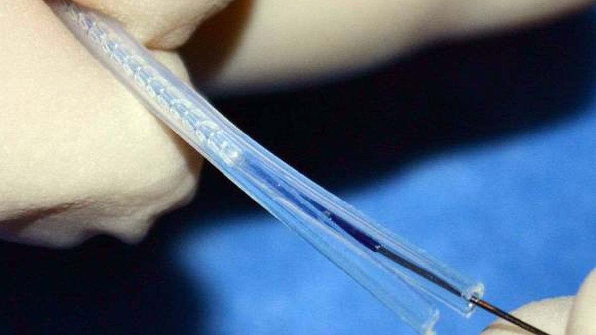 Diseñan stent que se disuelve con el tiempo